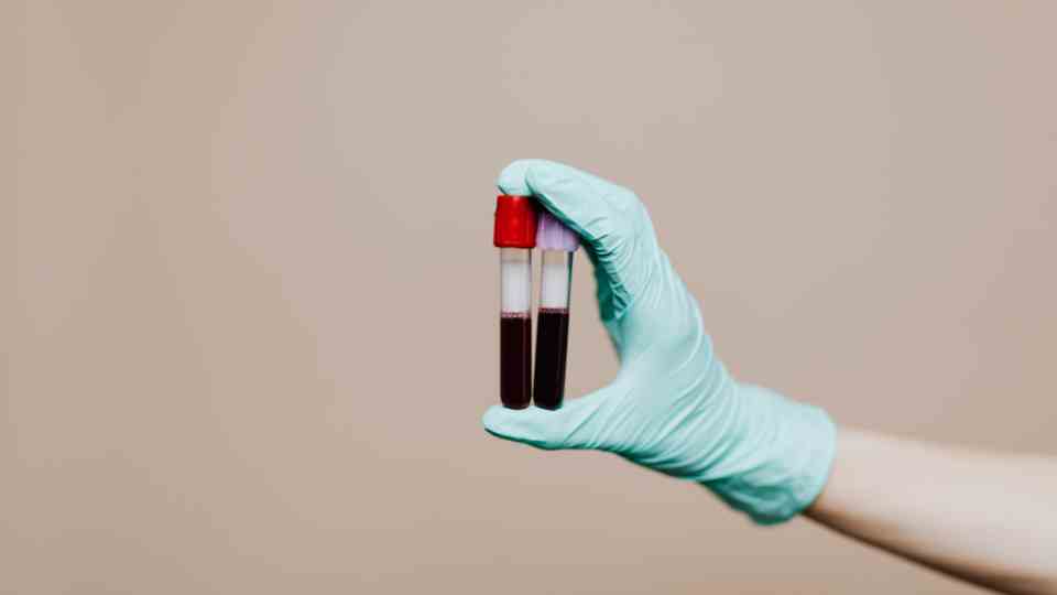 Can a Blood Test Detect Cancer? Get the Facts - Cadogan Pharmacy